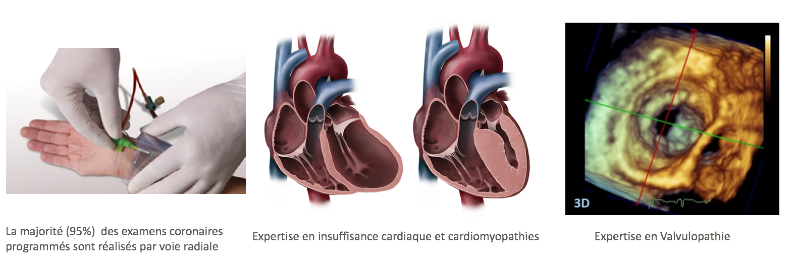 Département de Cardiologie | Hôpitaux Universitaires Pitié Salpêtrière
