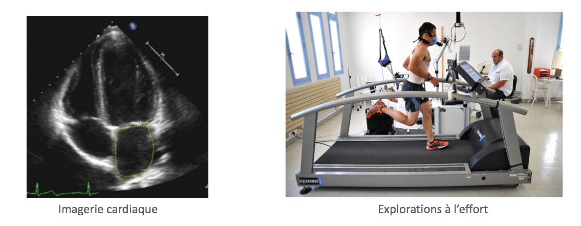 Département de Cardiologie | Hôpitaux Universitaires Pitié Salpêtrière